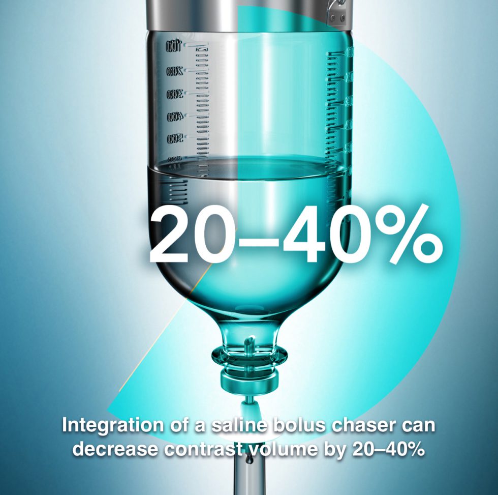 Eliminate Excess Contrast With Saline - SmartInject Solutions