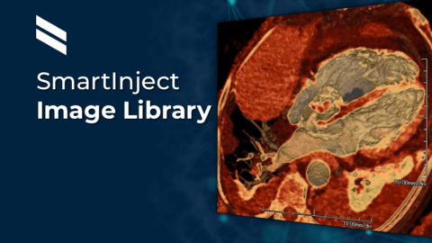 Image Library - SmartInject Solutions